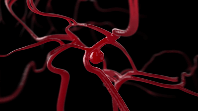 A Membrane for Superior Neurovascular Treatment - NV MedTech